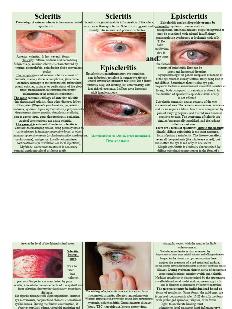 Scleritis and Episcleritis | PDF | Immunology | Clinical Medicine