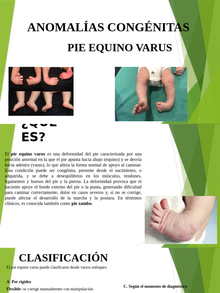 Pie Equino Varus: Causas y Tratamiento | PDF | Pie | El embarazo