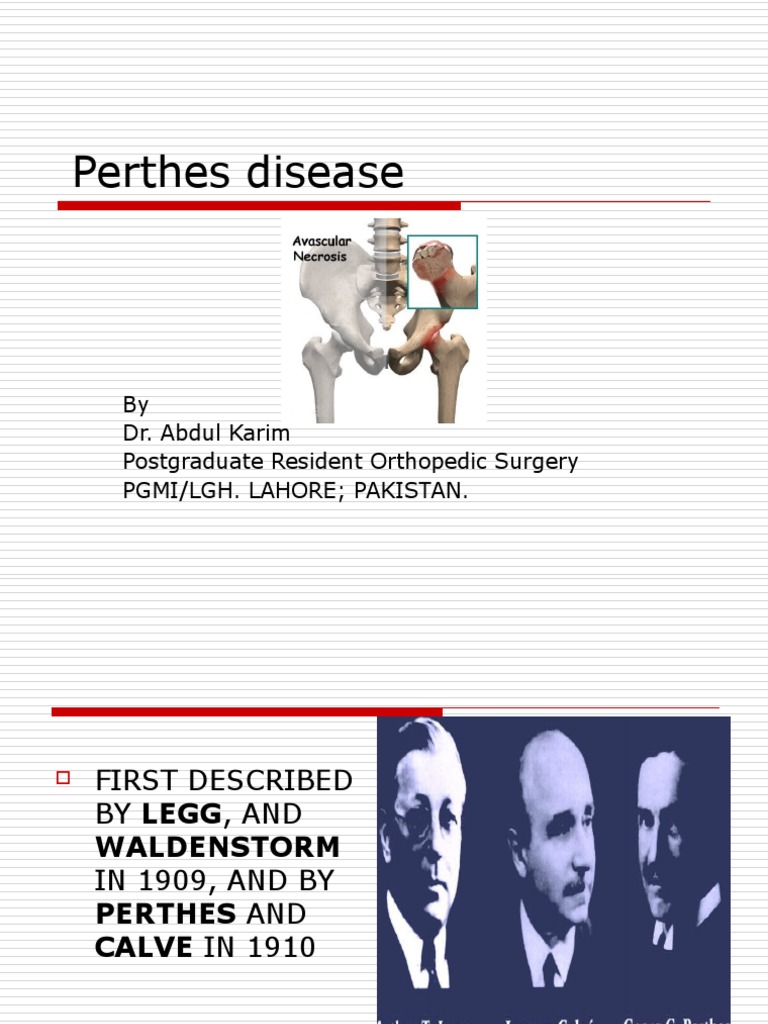 Perthes Disease: by Dr. Abdul Karim Postgraduate Resident Orthopedic ...