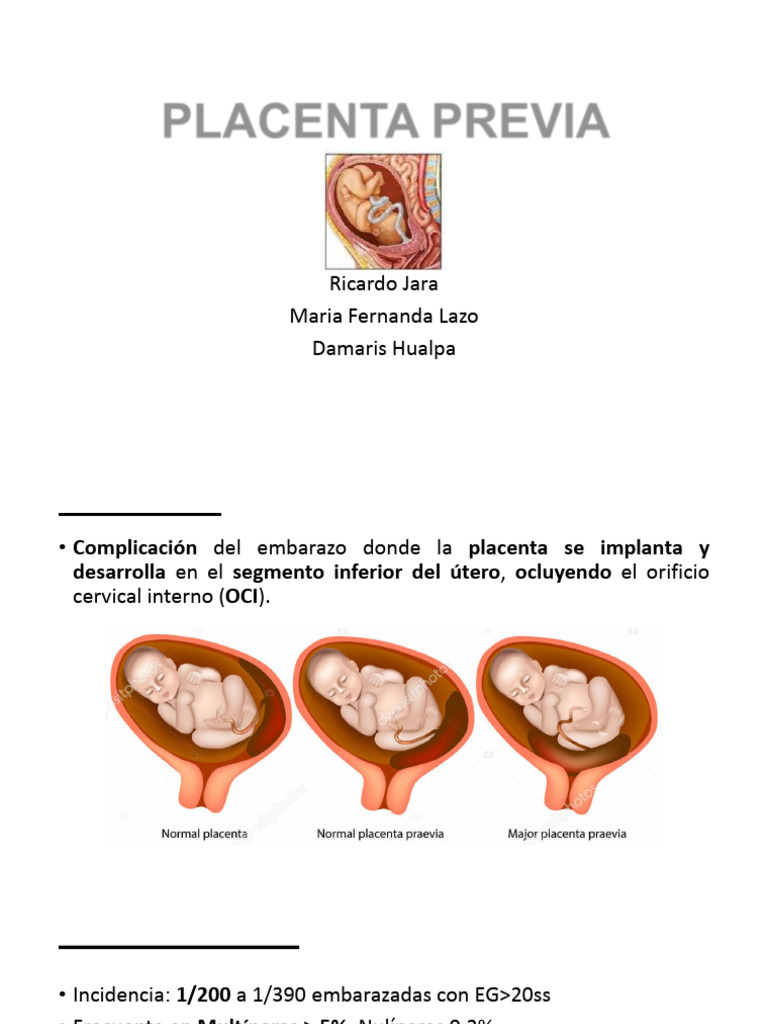 Grupo 5 Placenta Previa | PDF | Obstetricia | La salud de la mujer