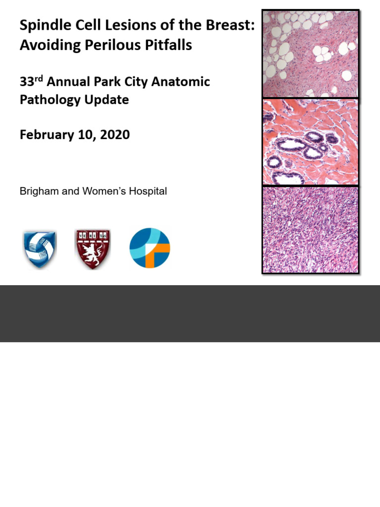 Spindle Cell Lesions of The Breast - Lecture Slides | PDF | Carcinoma ...