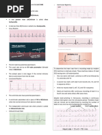 ECG Rate Interpretation: The Standard Paper Speed Is 25mm/sec | PDF ...