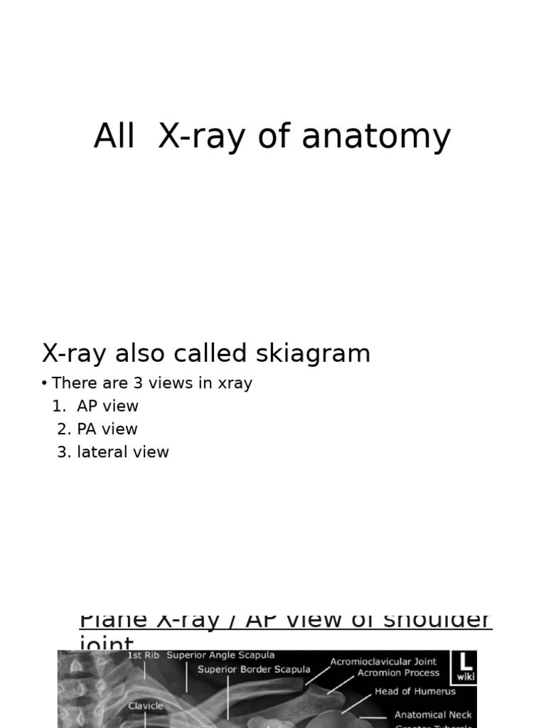 All X-Ray of Anatomy | PDF