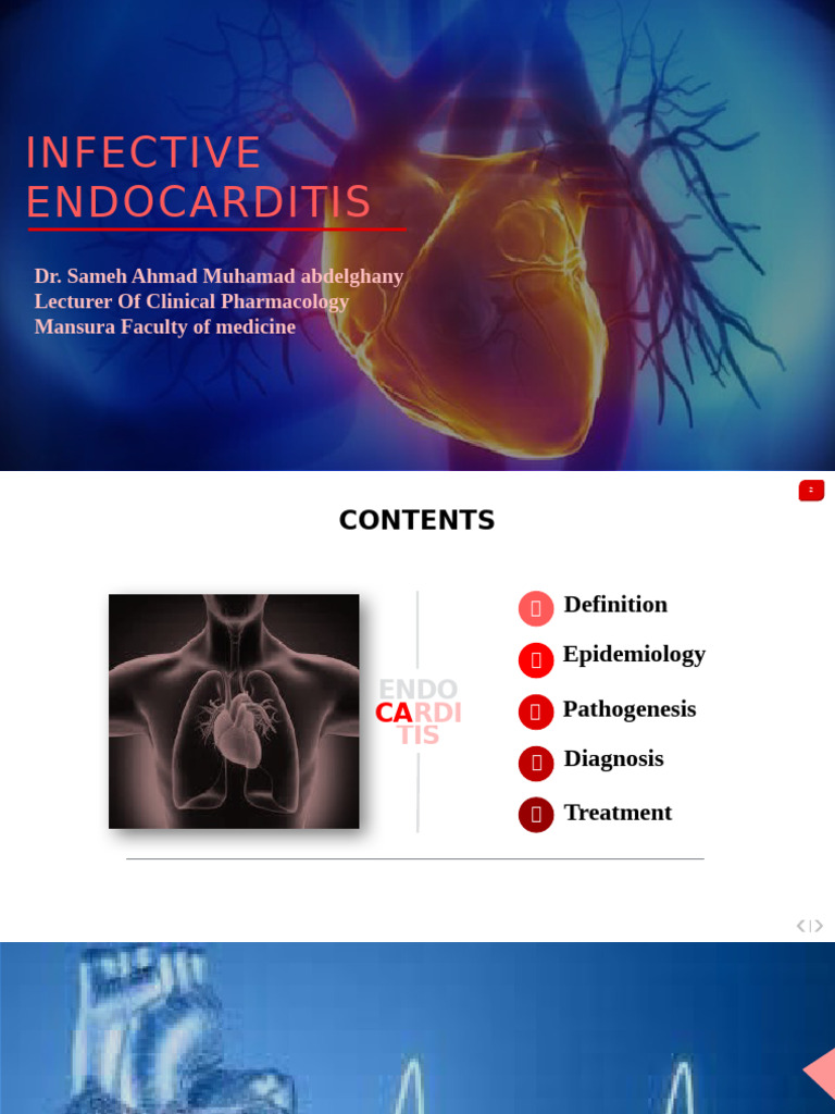 endocarditis-180320193131 (1) | PDF | Medical Specialties | Microbiology