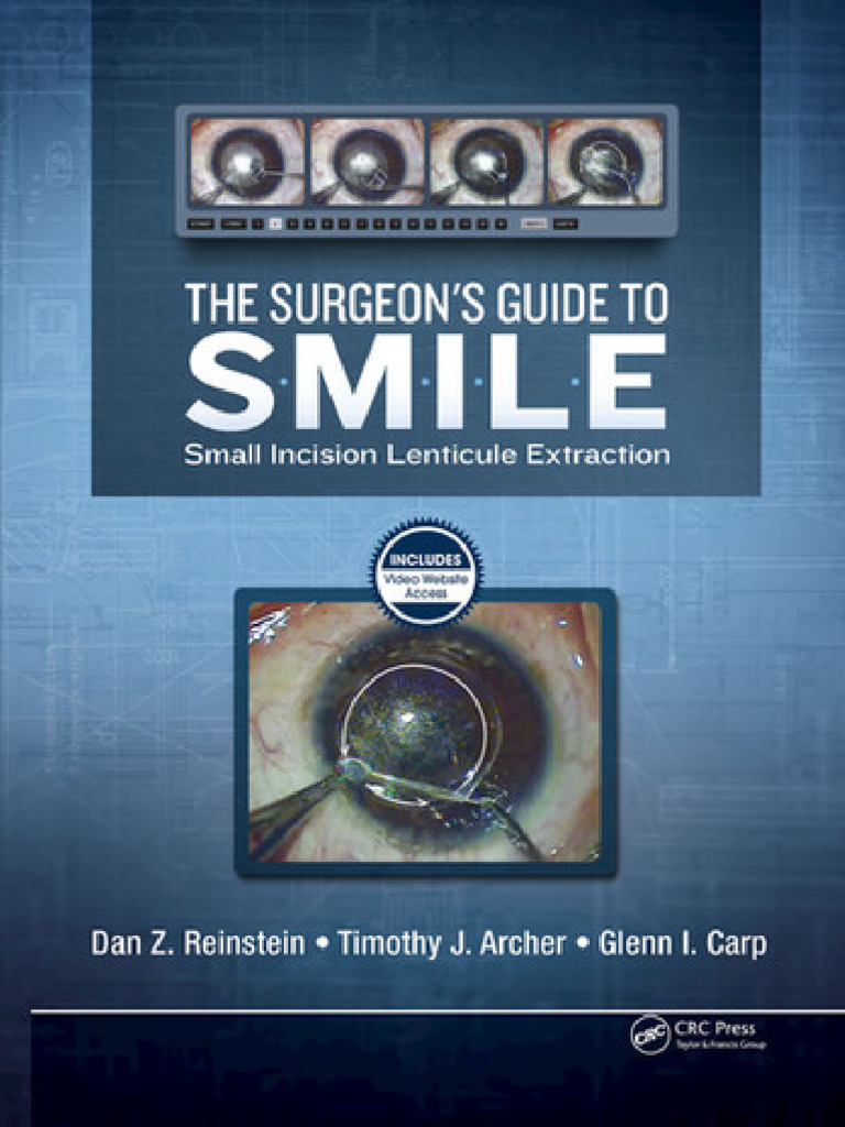 The Surgeon's Guide To SMILE: Small Incision Lenticule Extraction | PDF