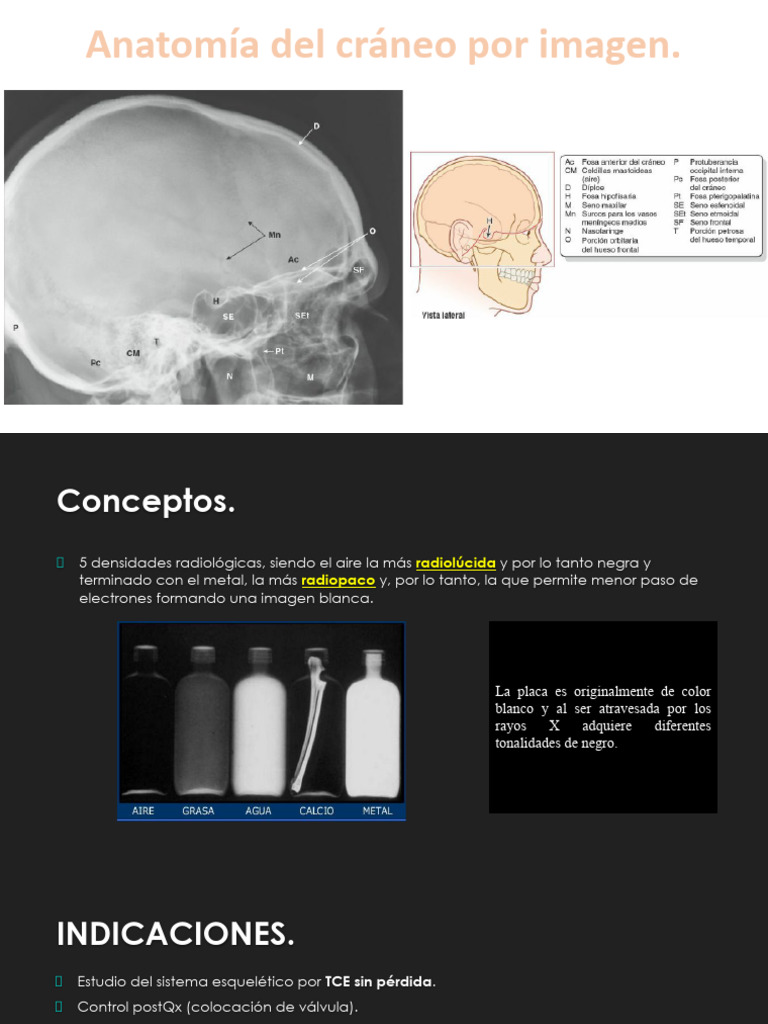 Anatom-A Del Cr-Neo Por Imagen. SIN VIDEO | PDF | Cabeza y cuello humanos | Anatomía humana