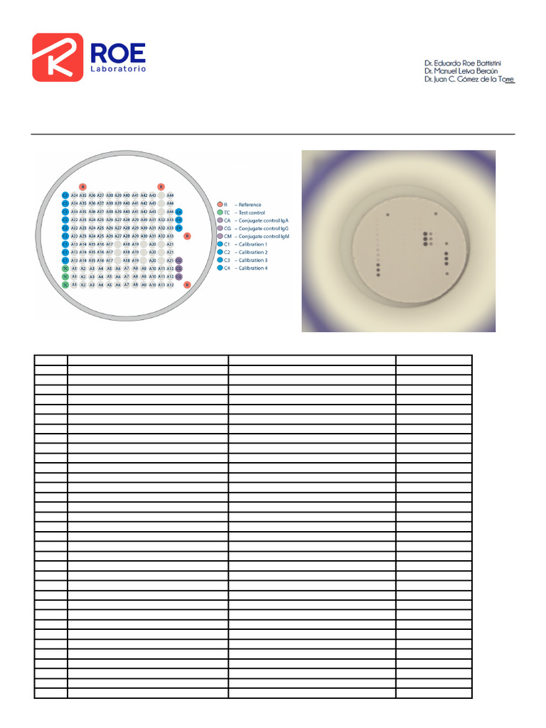 Perfil Ena (Microblot Array Ana 44 Antígenos) - 303159660 | PDF