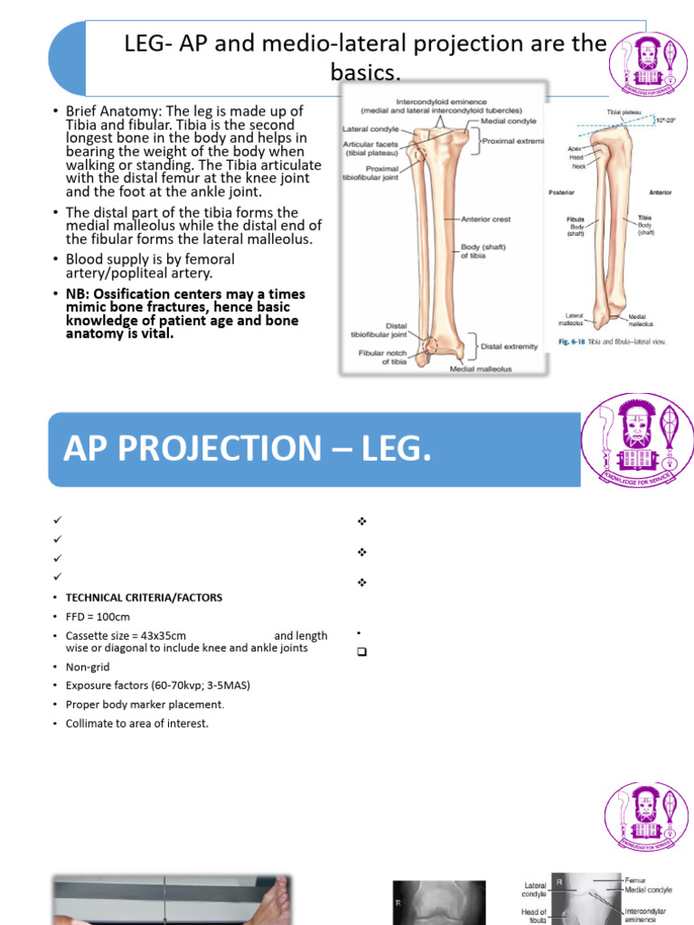 Leg and Knee X-Ray Projections Guide | PDF | Knee | Human Leg