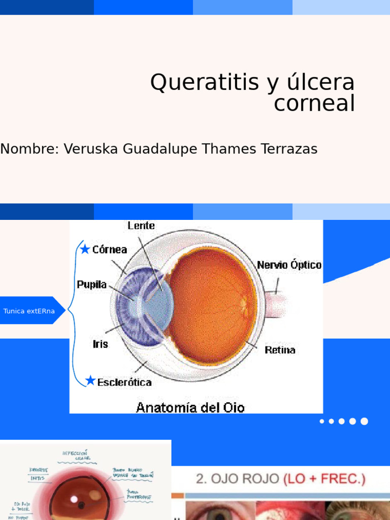 Queratitis y Úlcera Corneal: Nombre: Veruska Guadalupe Thames Terrazas ...