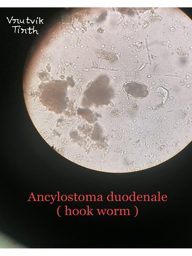 Stool Examination Slide | PDF