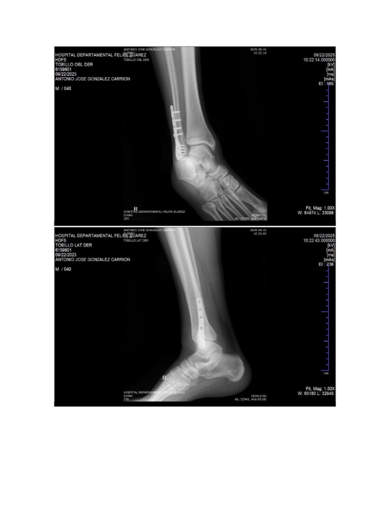 RADIOGRAFIAS | PDF
