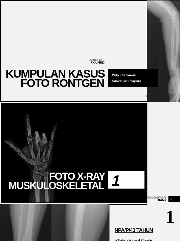 Atlas Case X-Ray | PDF