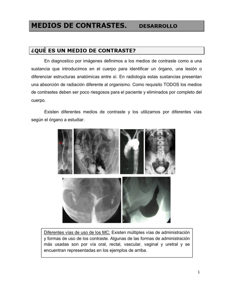 Medios de Contraste en Diagnóstico por Imágenes | PDF | Alergia ...