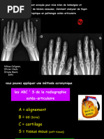 Radiographie de la cheville et du pied | PDF | Pied | Système squelettique