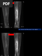 Radiographie de la cheville et du pied | PDF | Pied | Système squelettique