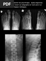 Radiographie de la cheville et du pied | PDF | Pied | Système squelettique