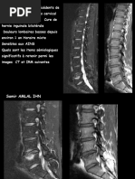 Radiographie de la cheville et du pied | PDF | Pied | Système squelettique