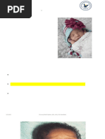 Lubchenco Curve PDF | PDF | Childhood | Public Health