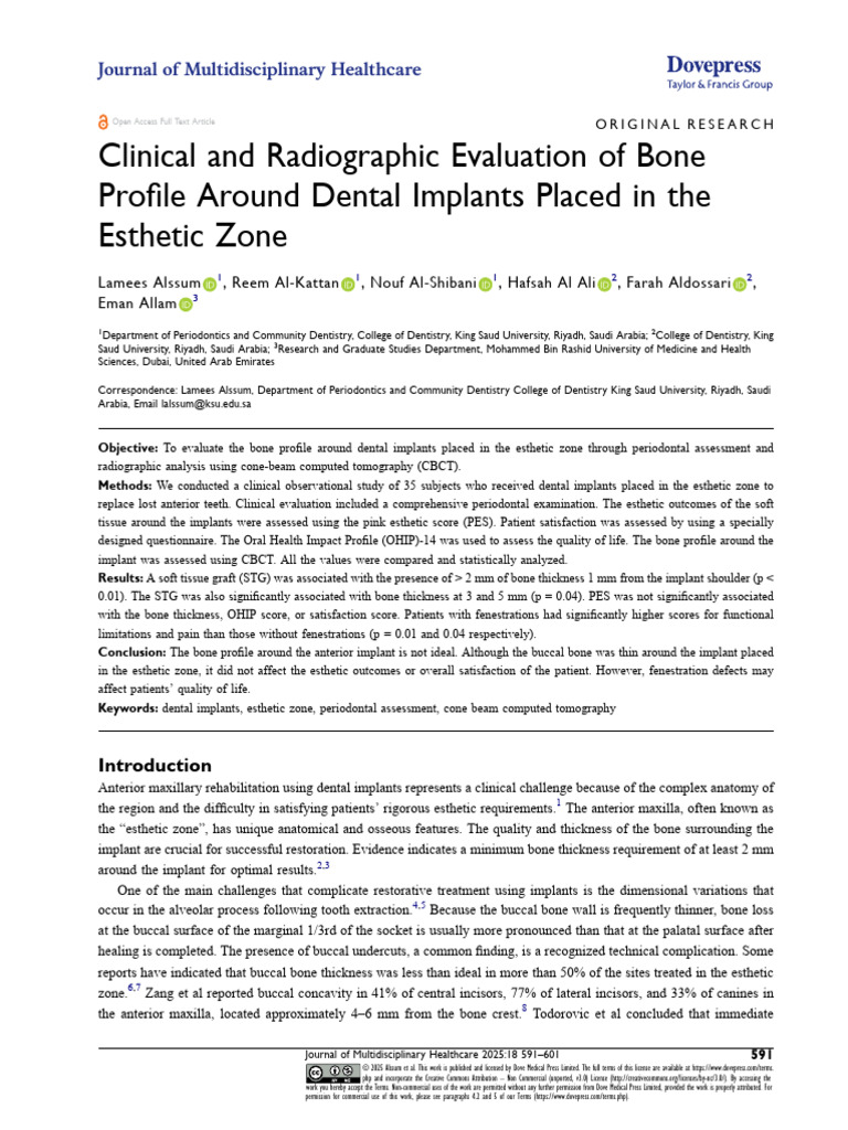 Bone Profile Around Dental Implants | PDF | Dental Implant | Dentistry