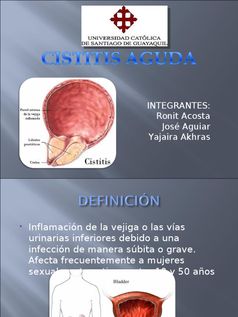 Cistitis Aguda Presentacion | PDF | Sistema urinario | Vejiga urinaria