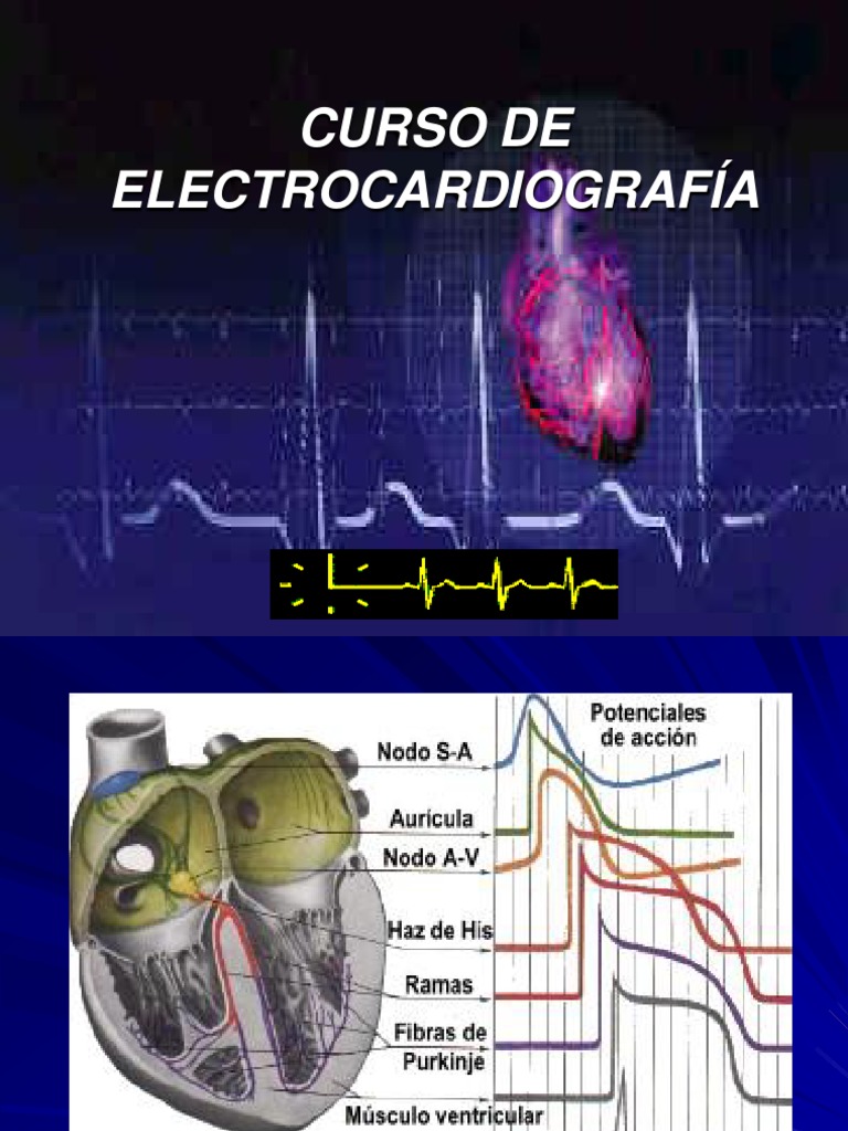 Curso de Electrocardiografía | PDF | Electrocardiografia | Arritmia cardiaca