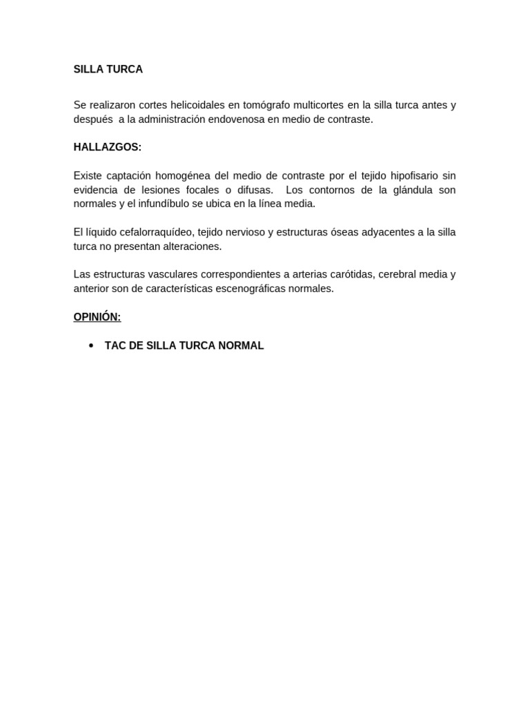 Silla Turca | PDF