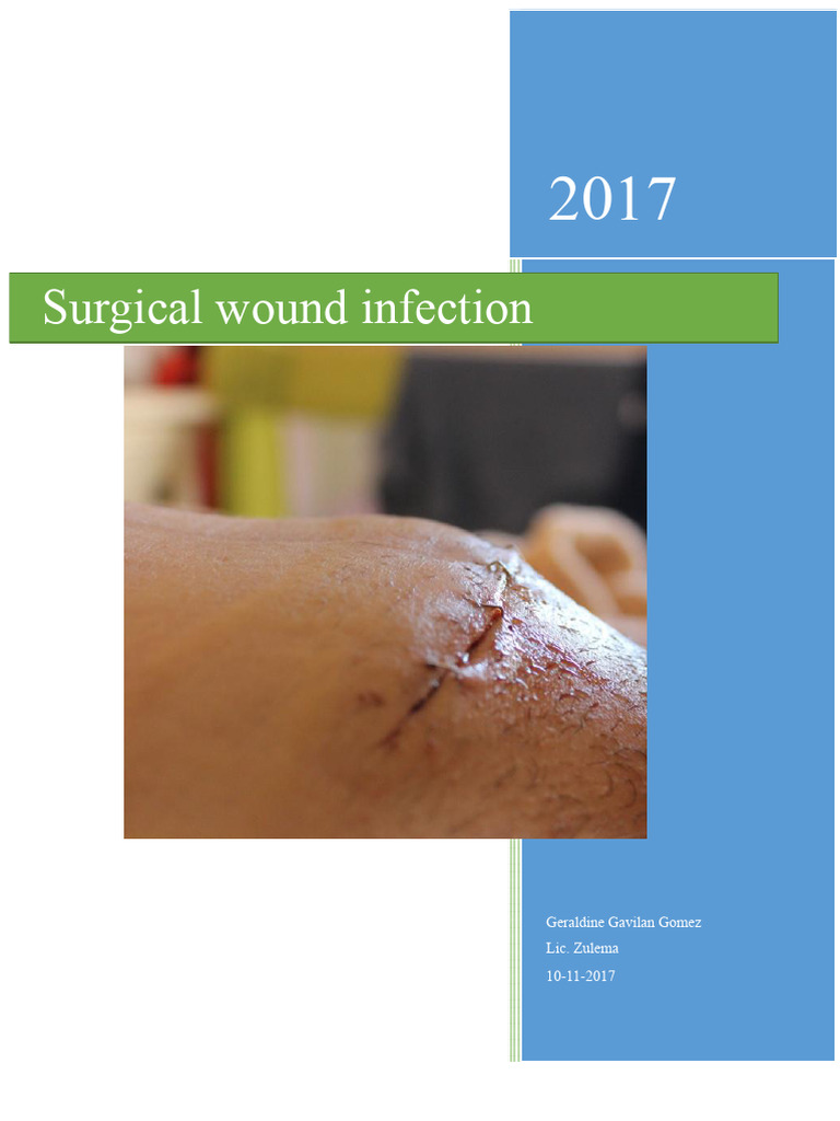 Surgical Wound Infection | PDF | Surgery | Infection