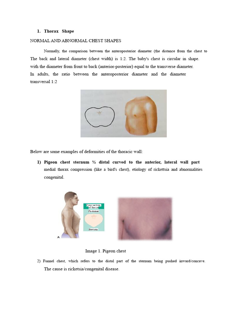 Thorax Shape | PDF