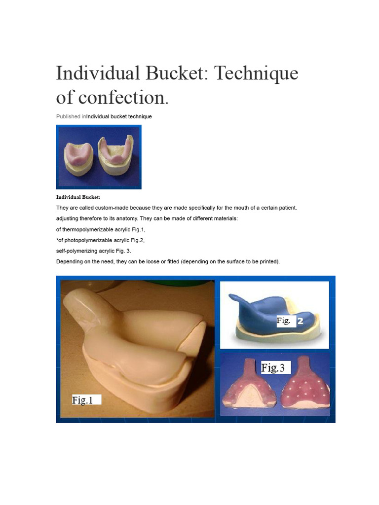 Individual Buckets Definition | PDF