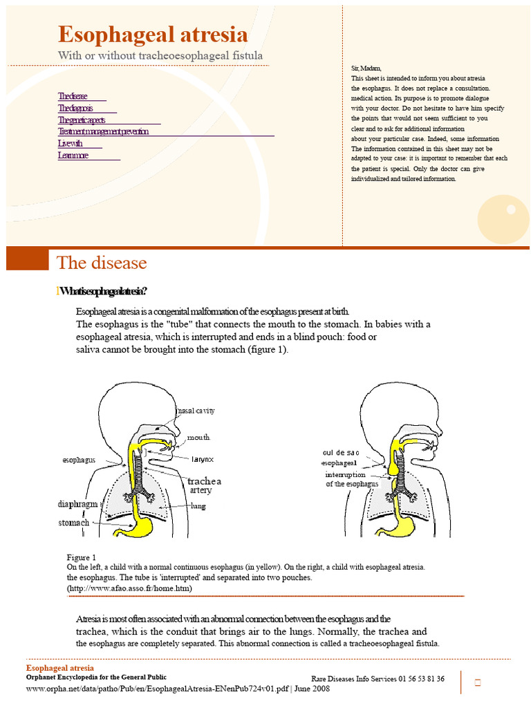 Understanding Esophageal Atresia | PDF | Esophagus | Gastroesophageal ...