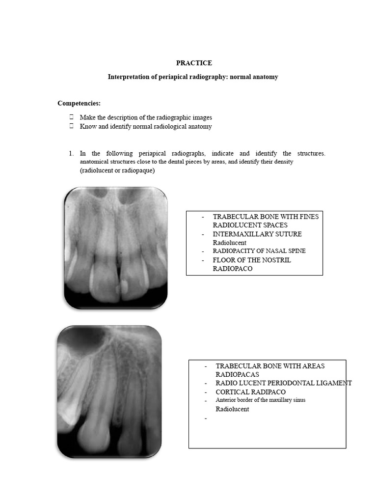 Periapical Radiography Anatomy Guide | PDF | Dental Anatomy | Dentistry ...