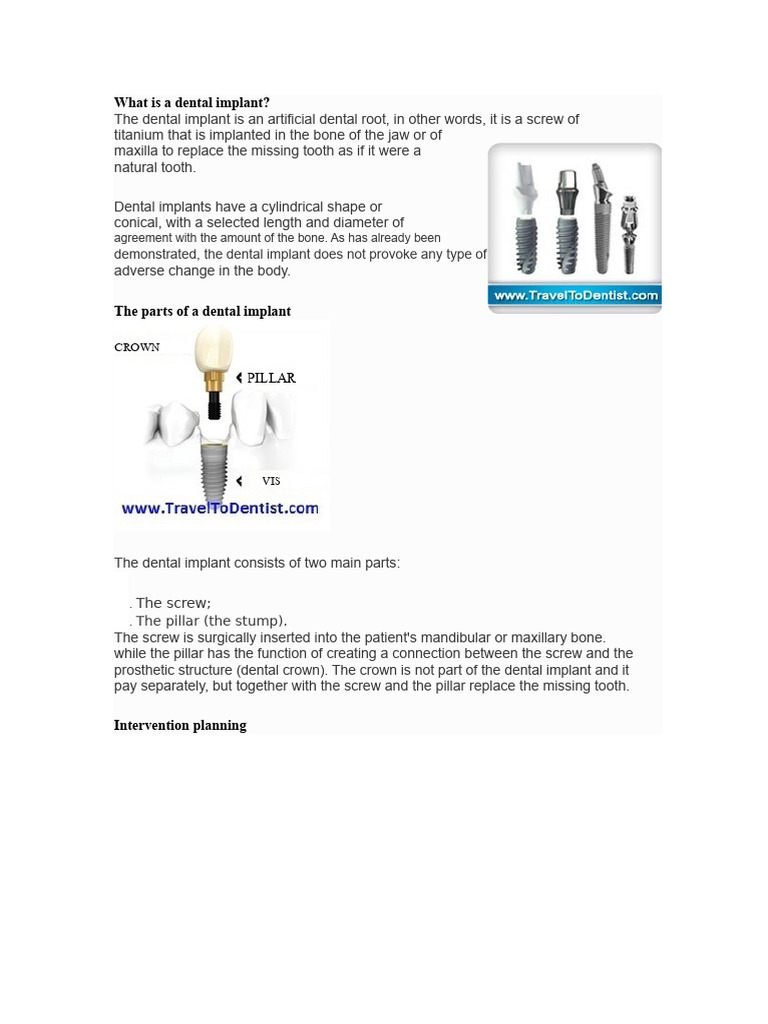 What Is A Dental Implant? | PDF | Dental Implant | Dentistry