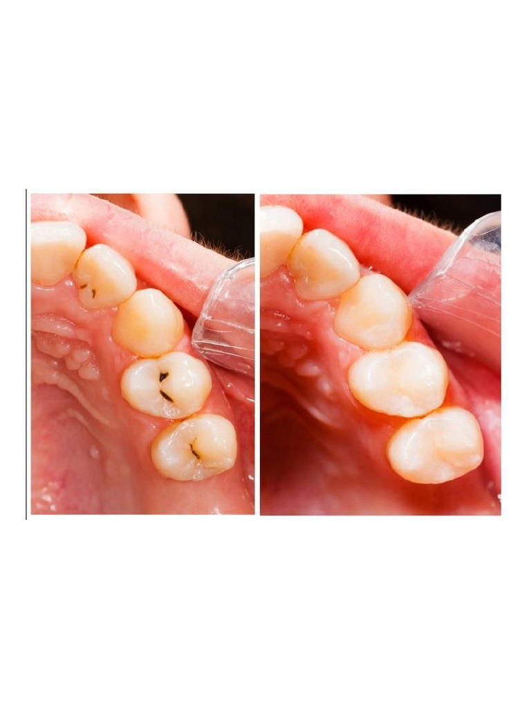 Carries Different Types | PDF