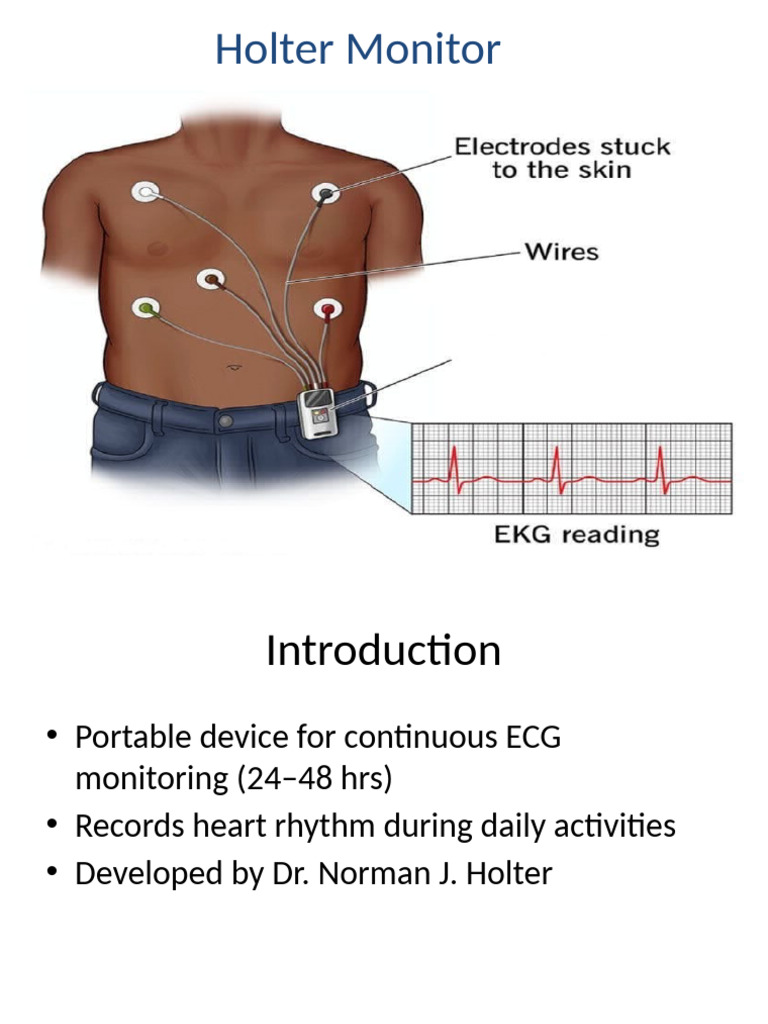 Holter Monitor: Continuous ECG Overview | PDF