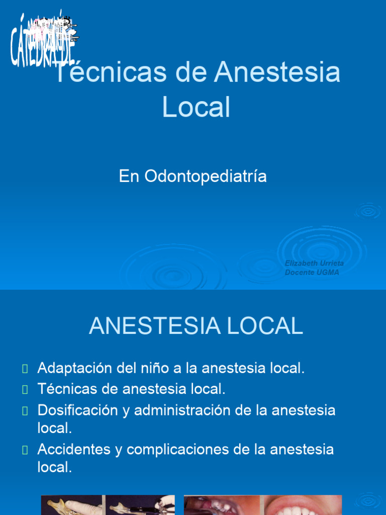 Técnicas de Anestesia Local en Odontopediatría | PDF | Anestesia ...