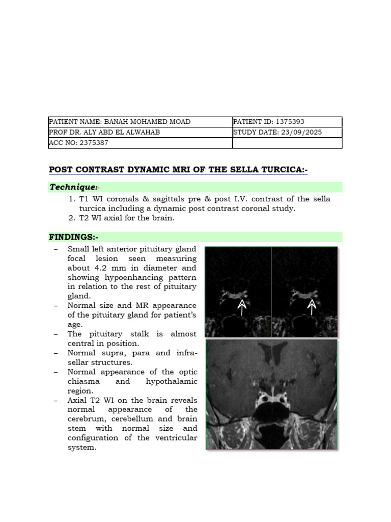 Post Contrast Dynamic Mri of The Sella Turcica:-: Technique | PDF