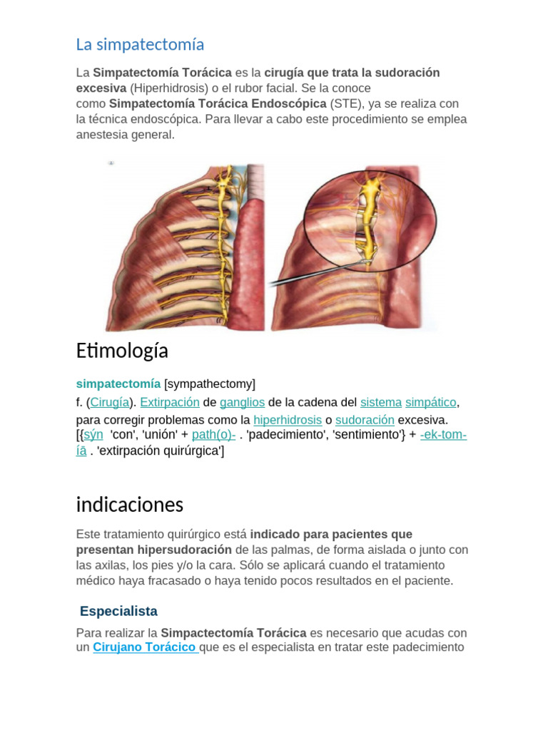Simpatectomía Torácica para Hiperhidrosis | PDF