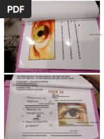 Gans Sensory Organization Performance (SOP) Test | PDF | Vertigo ...