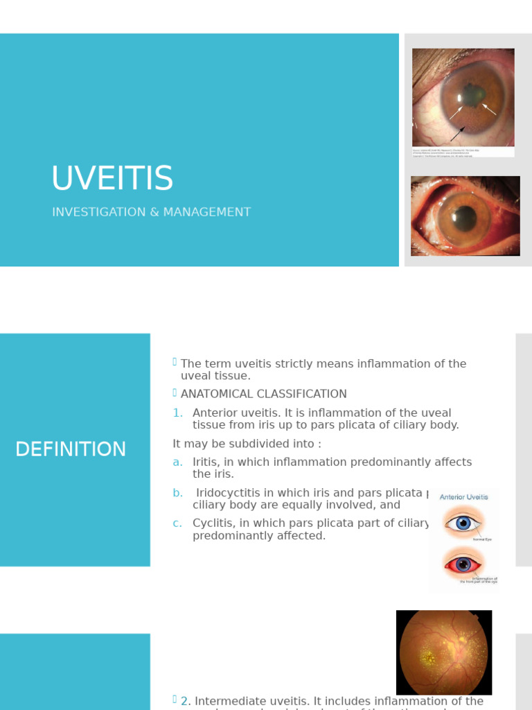 Investigation and Management of Uveitis Tutorial | PDF | Corticosteroid ...