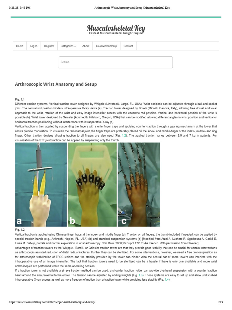 Traction Systems for Wrist Arthroscopy | PDF | Thumb | Hand