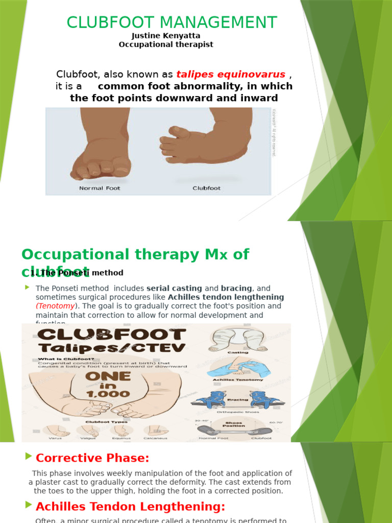 Clubfoot Management: Ponseti Method Guide | PDF | Foot ...