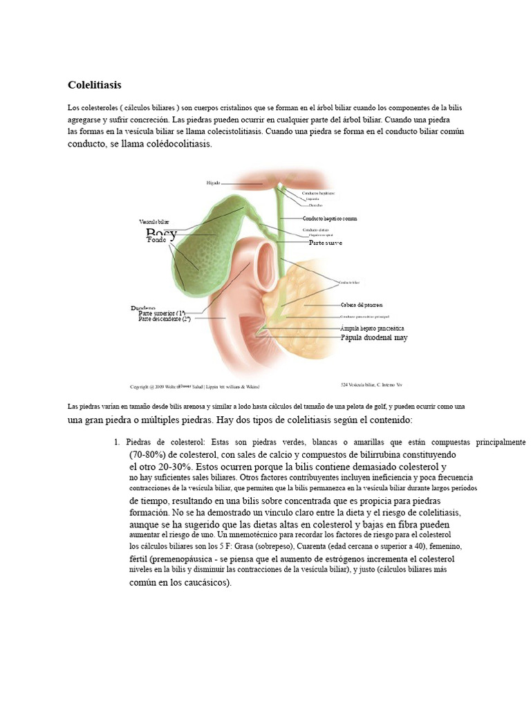 Colelitiasis | PDF | Bilis | Vesícula biliar