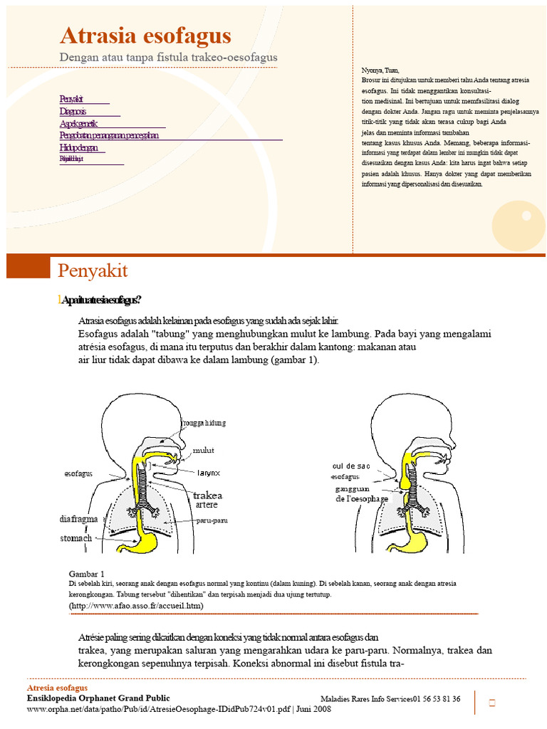 Memahami Atrasia Esofagus pada Bayi | PDF