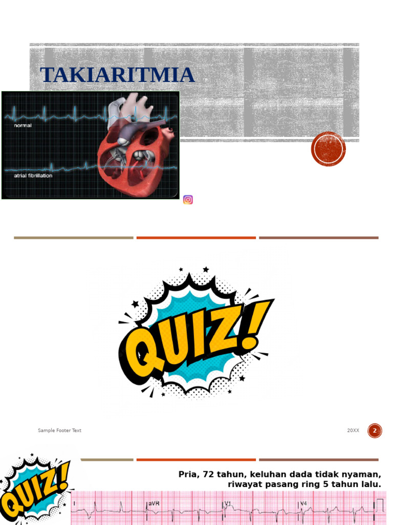 Materi EKG Takiaritmia | PDF