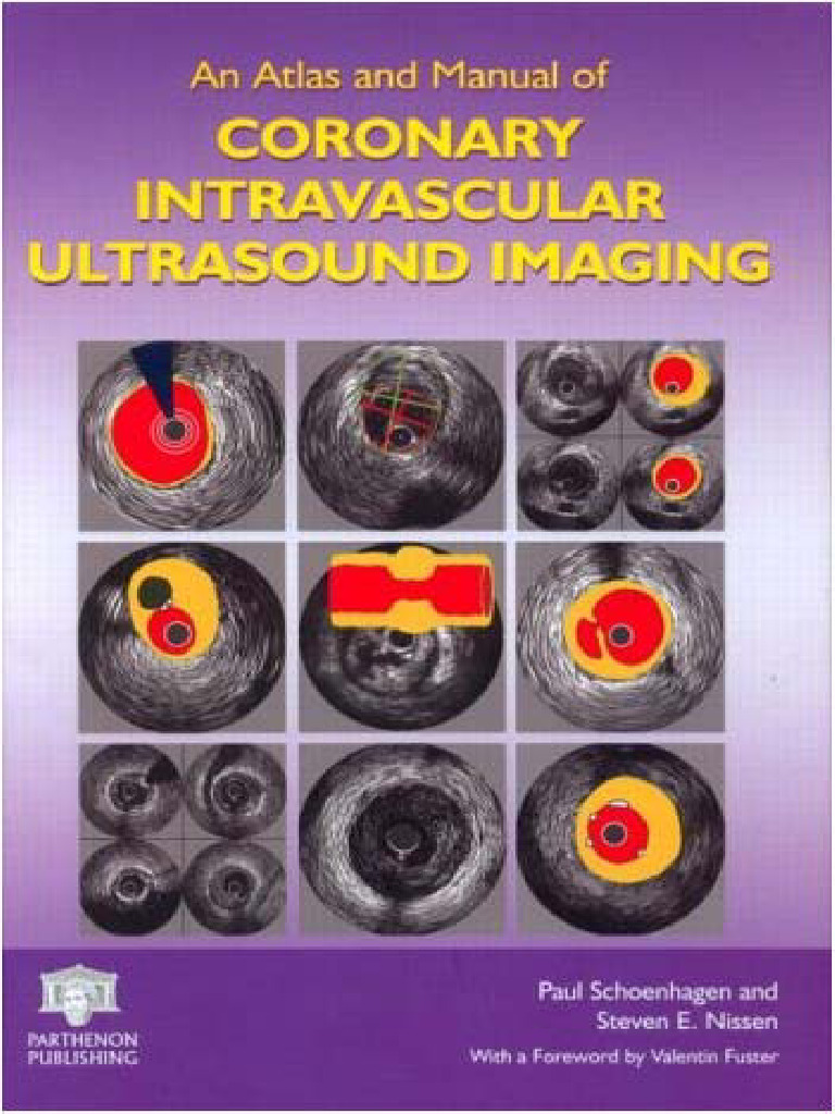An Atlas and Manual of Coronary Intravascular Ultrasound Ima | PDF