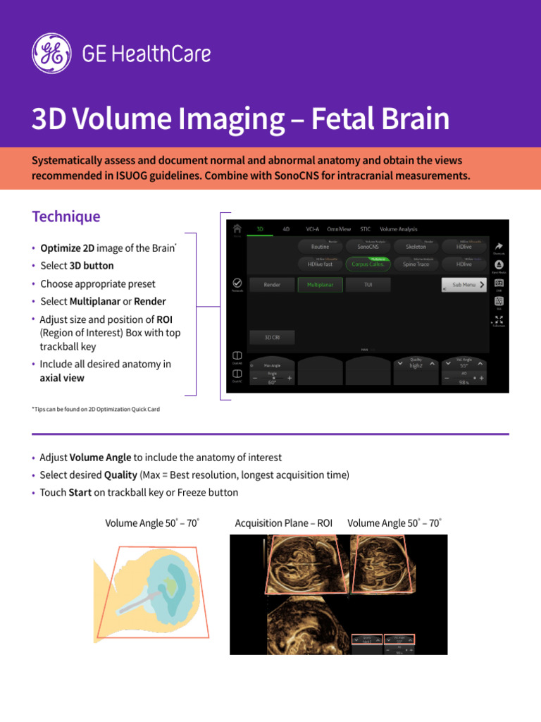 2024 Voluson 3d Volume Imaging Brain Quick Card Jb29445xx | PDF | Imaging