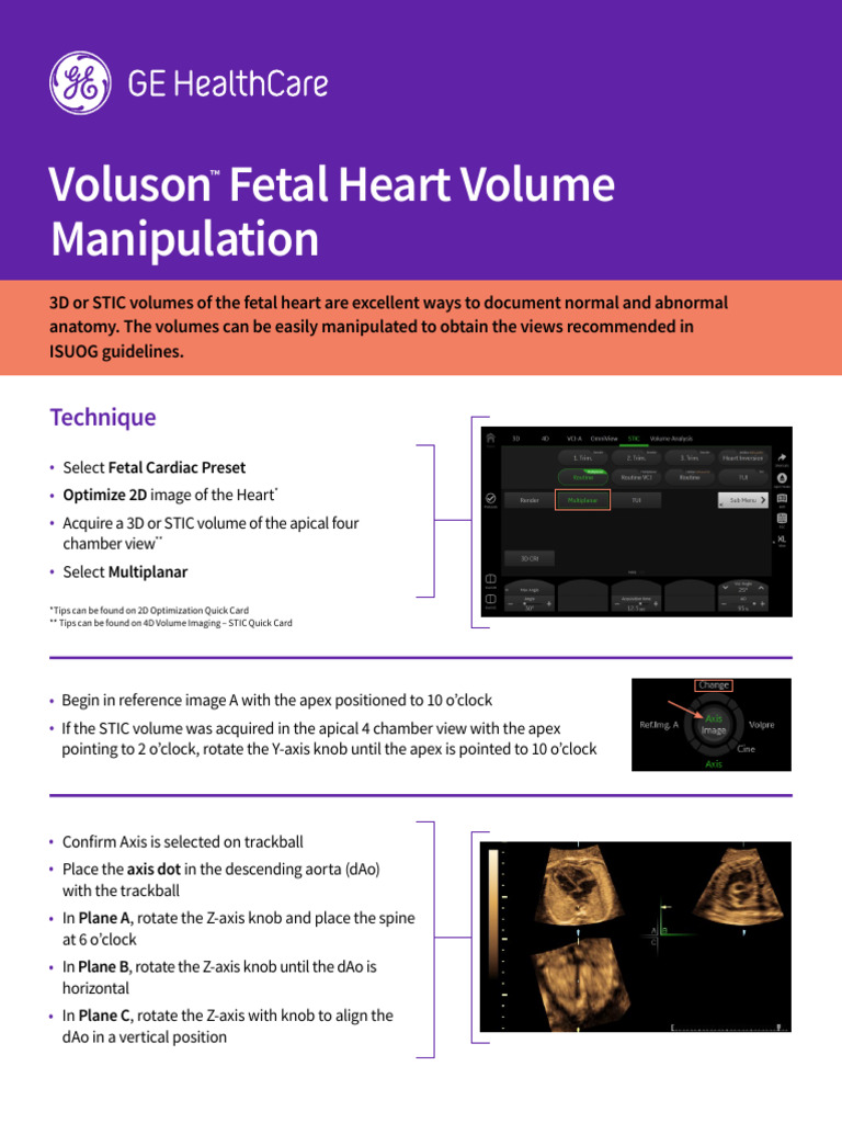 2024 Voluson Fetal Heart Volume Quick Card Jb29447xx | PDF | Heart | Aorta