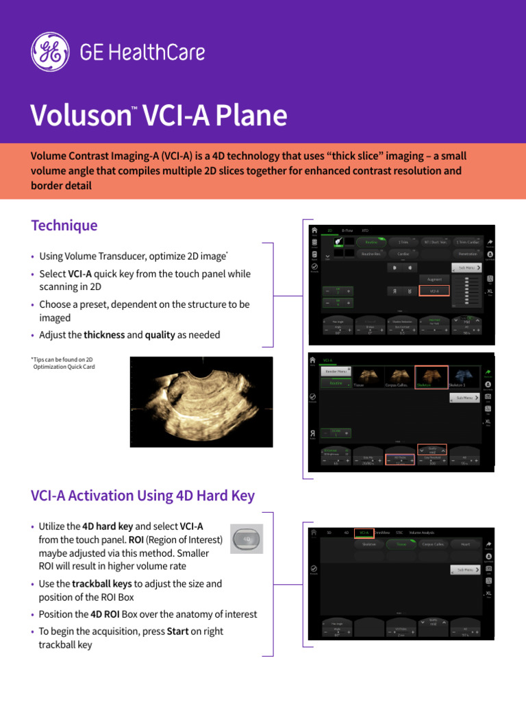 2024 Voluson Vci Quick Card Jb30044xx | PDF