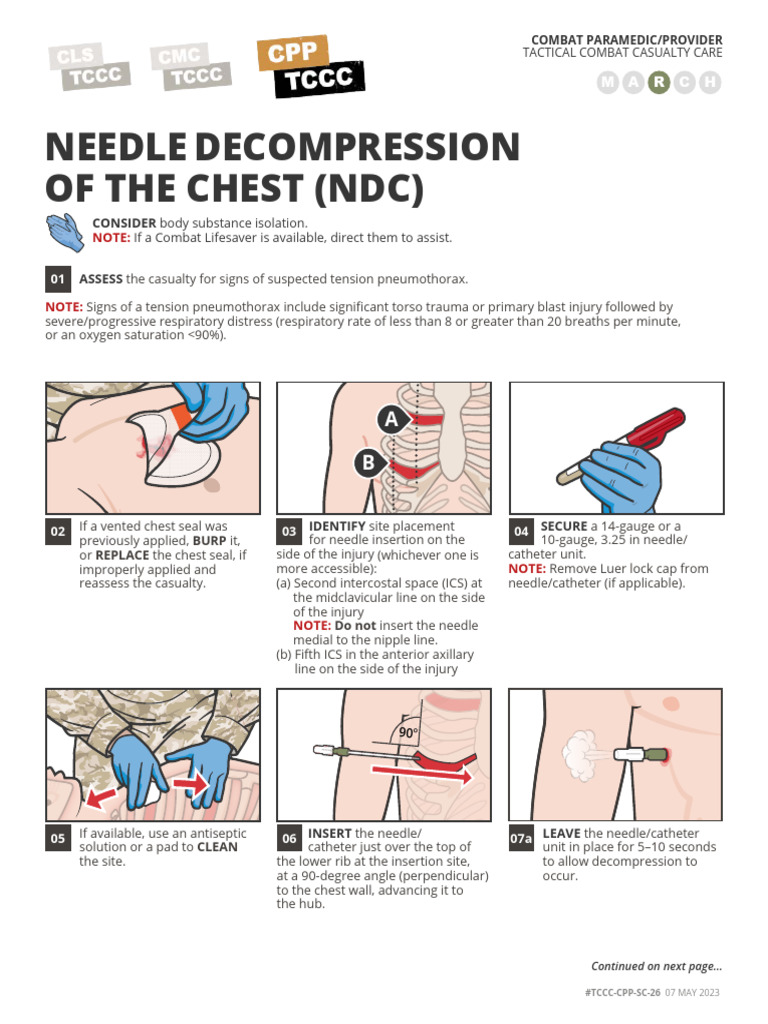 TCCC CPP Skill Card 27 Needle Compression of Chest en | PDF ...