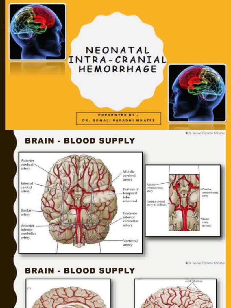 Neonatal Intracranial Hemorrhage | PDF